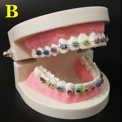 1PC Dental Orthodontic teeth Model Typodont With Ortho Metal brackets ...