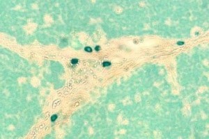 Microscopy stains: Janus Green powder 5g CI11050 for mitochondria | eBay