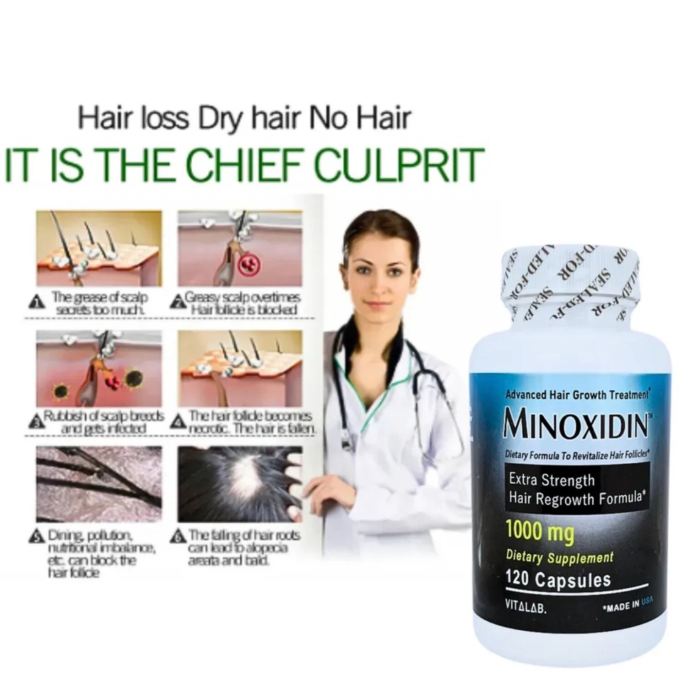 120 Tablet Minoxidin 1000mg Hair Treatment Regrowth Extra Strength Men ...