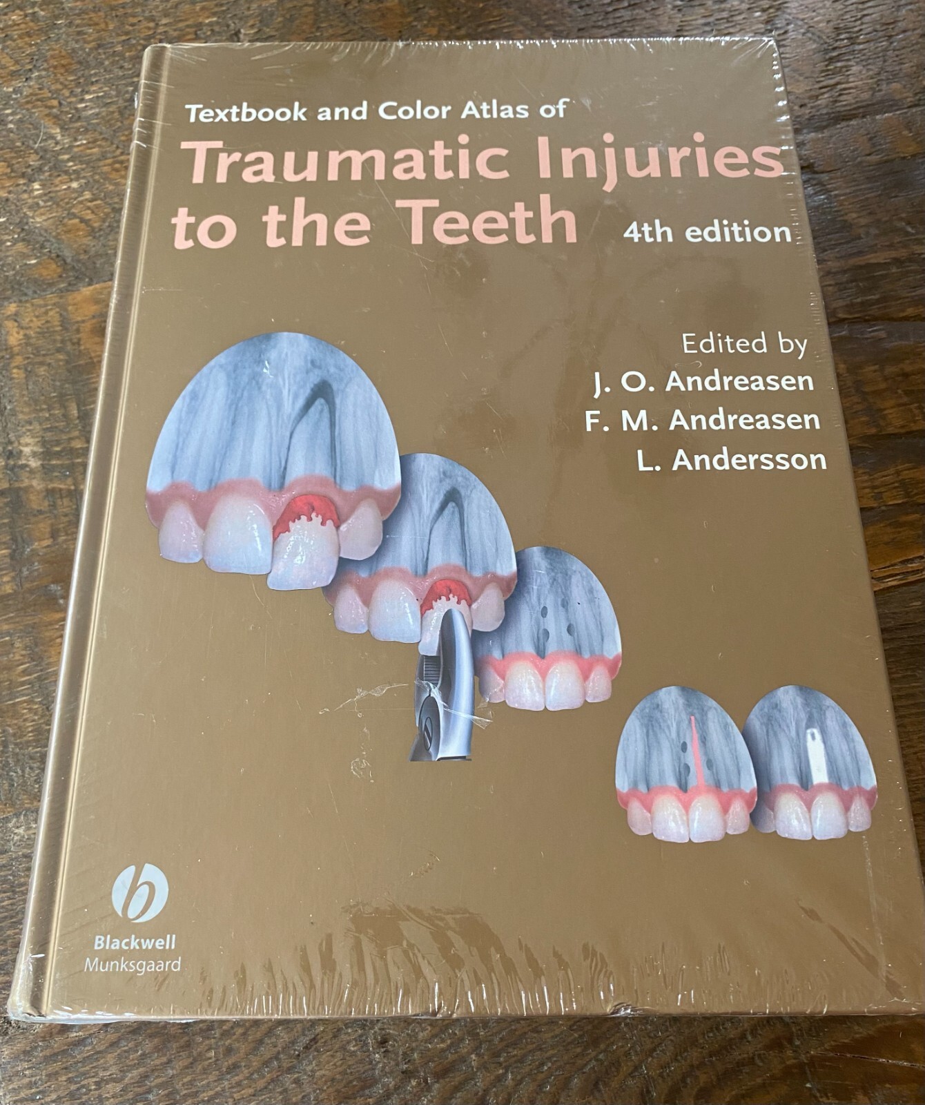 Textbook and Color Atlas of Traumatic Injuries to the Teeth by Jens ...
