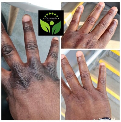 Dark knuckles remover Oil | eBay UK