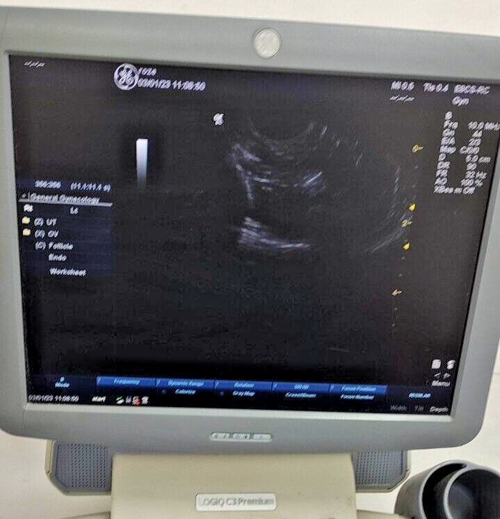 GE LOGIQ C3 Premium Ultrasound Machine 2 Probes. Abdominal and Vaginal ...