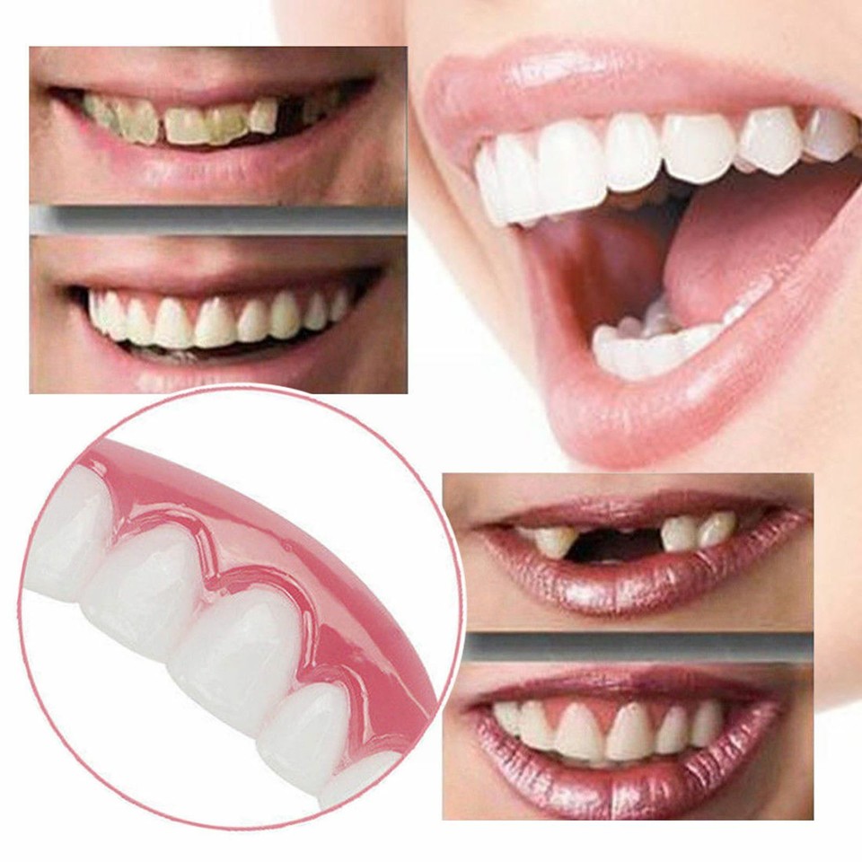 Perfect Smile Veneers Instant Cosmetic Teeth Cover Fix Snap On One Size ...