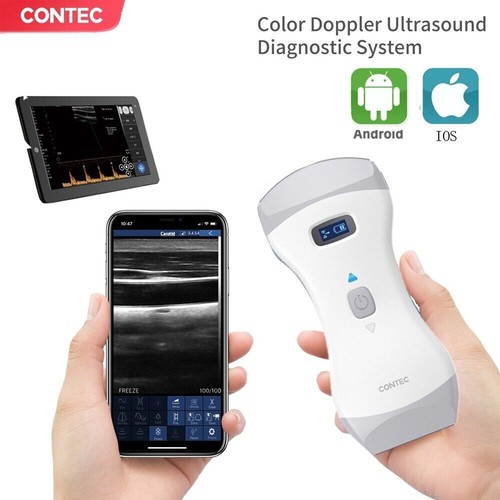 3 in 1 Double head Color doppler Mini Wifi handheld Wireless ultrasound ...