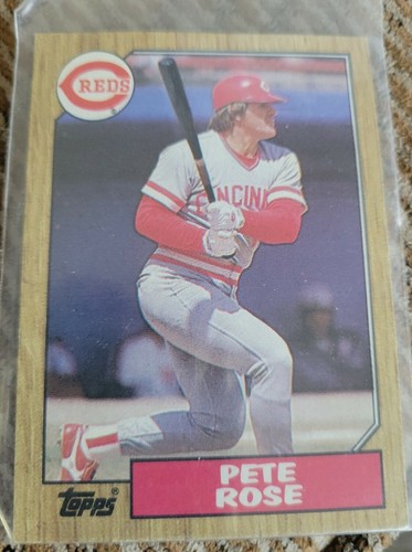 1987 Topps Pete Rose (Red Dot Error Card) | eBay