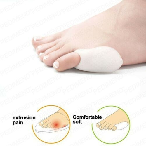 PEDIMEND™ Small Toe Bunion Separator Corrector Rubbing Relief Gel ...
