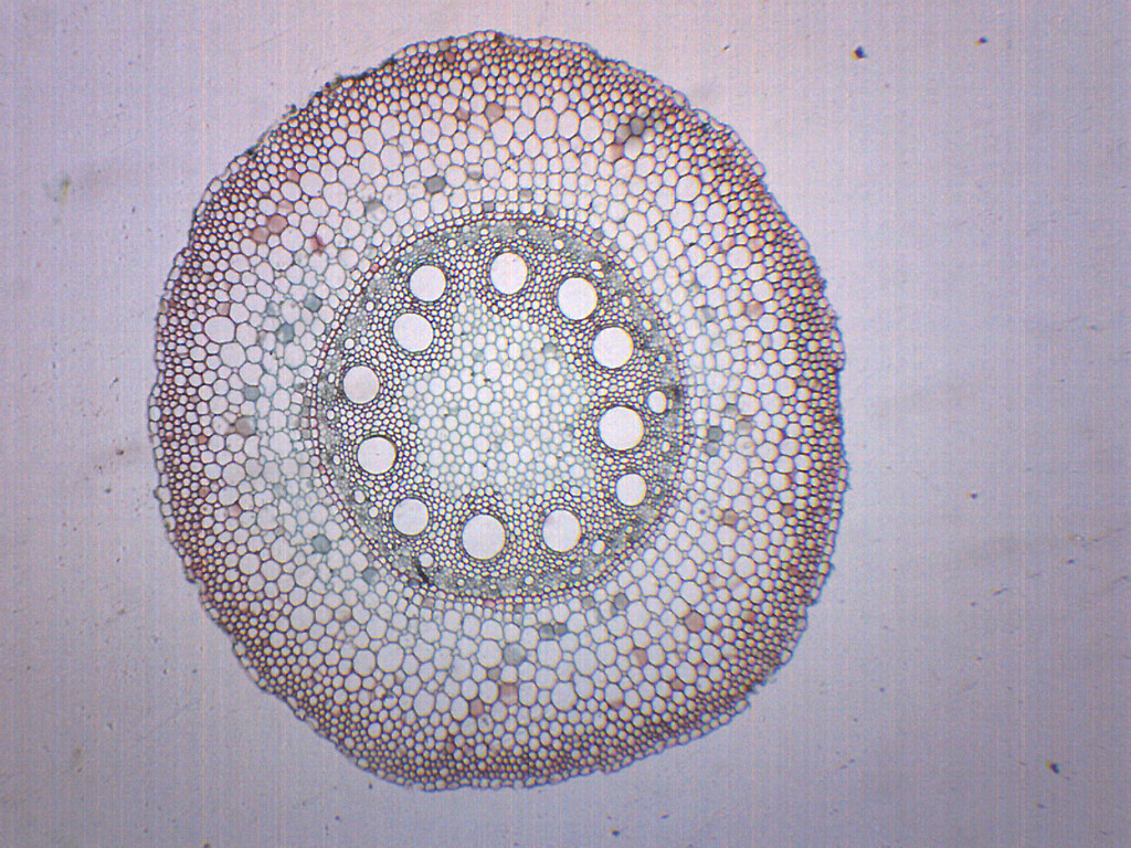 Dicot Root Cross Section Monocot Root Diagram | EasyBiologyClass
