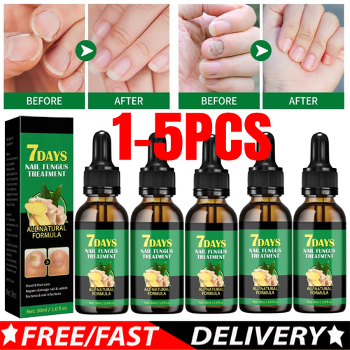 7 Days Nail Fungus Treatment All Natural Formula Gingers Nail Toenail ...