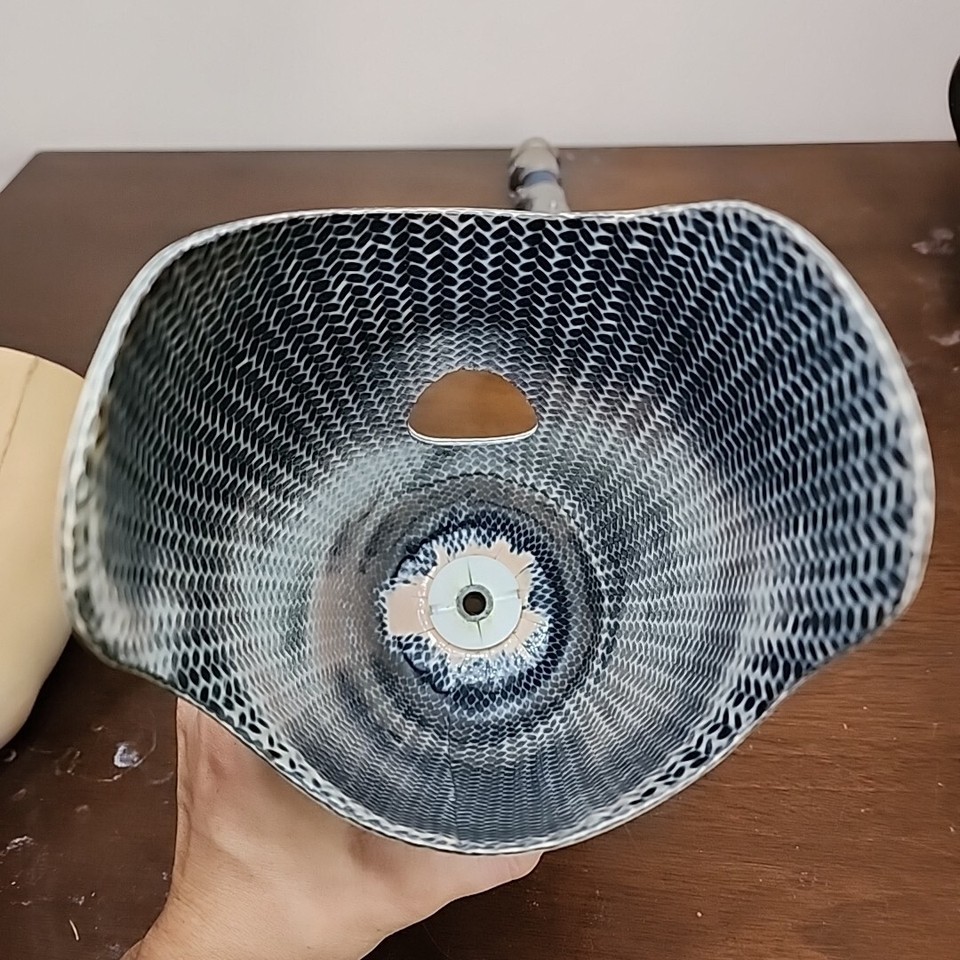 Flex-Foot Prosthetic Foot, Trulife Carbon Limb, Ossur Titanium Leg ...