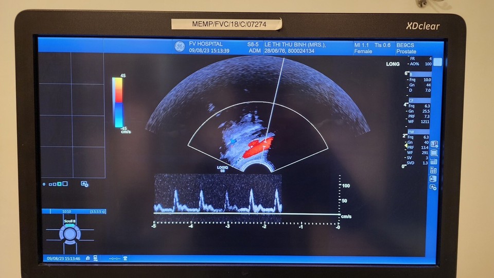Ge ultrasound probe BE9CS-D | eBay