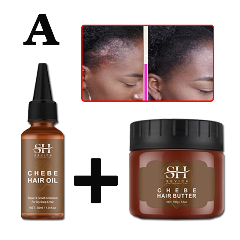 Sevich Chebe Hair Loss Treatment Spray Traction Alopecia Chebe Powder ...