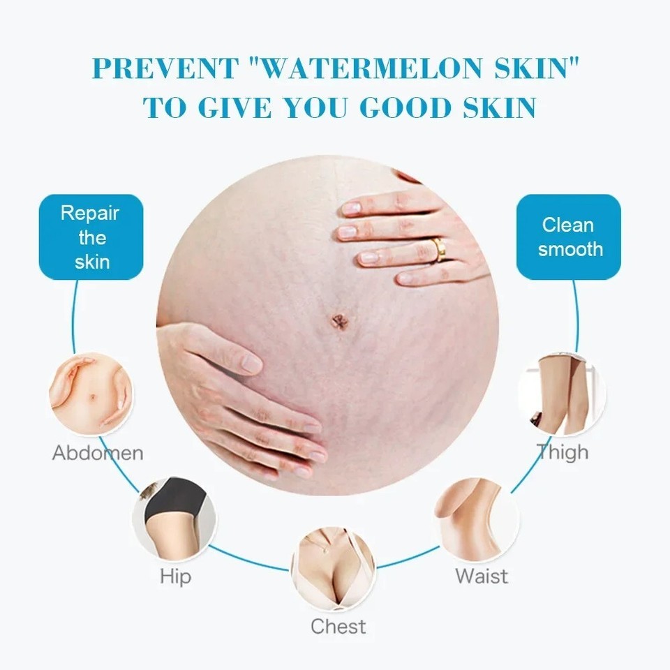 Pregnancy Scar Repair Cream Stretch Marks Removal Fat Stretch Mark ...