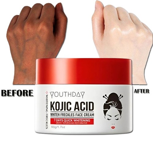 1PCS Dark Skin Permanent Whitening Cream Body Bleaching Lightening ...