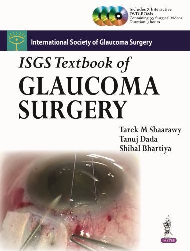 ISGS Textbook of Glaucoma Surgery by Tanuj Dada, Tarek Shaarawy and ...