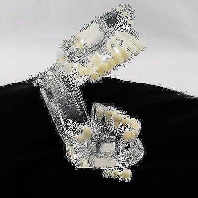 Dental Kit Full Teeth Restoration Removable Bridge Implant Set | eBay