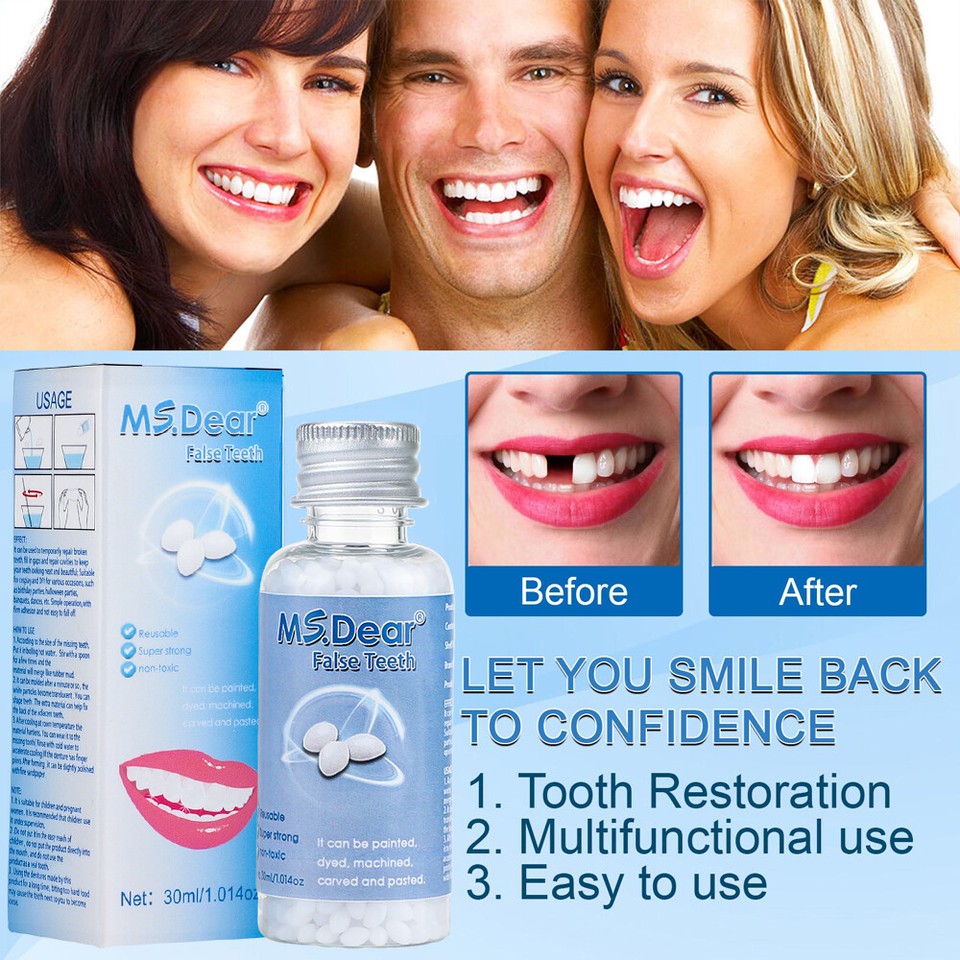 30ml MISSING TOOTH FILLER TEMPORARY COSMETIC REPLACEMENT REPAIR DIY ...