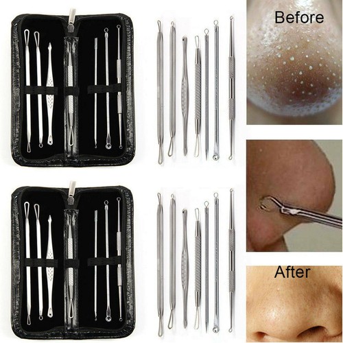 9x Blackhead Remover Tool Kit Spot Acne Pimple Comedone Extractor ...