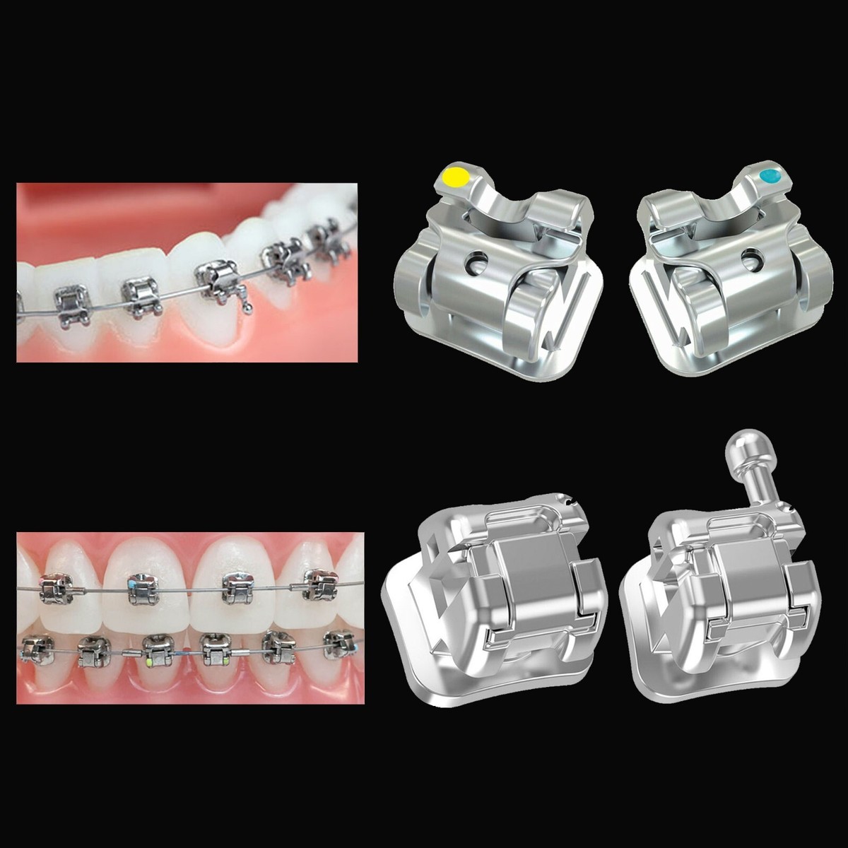 Damon Q Dental Orthodontic Self Ligating Bracket Roth MBT 022 Ormco