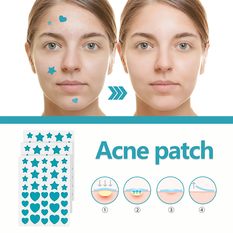 216pcs/box Acne Pimple Patch With Tea Tree Oil, Chamomile Oil ...