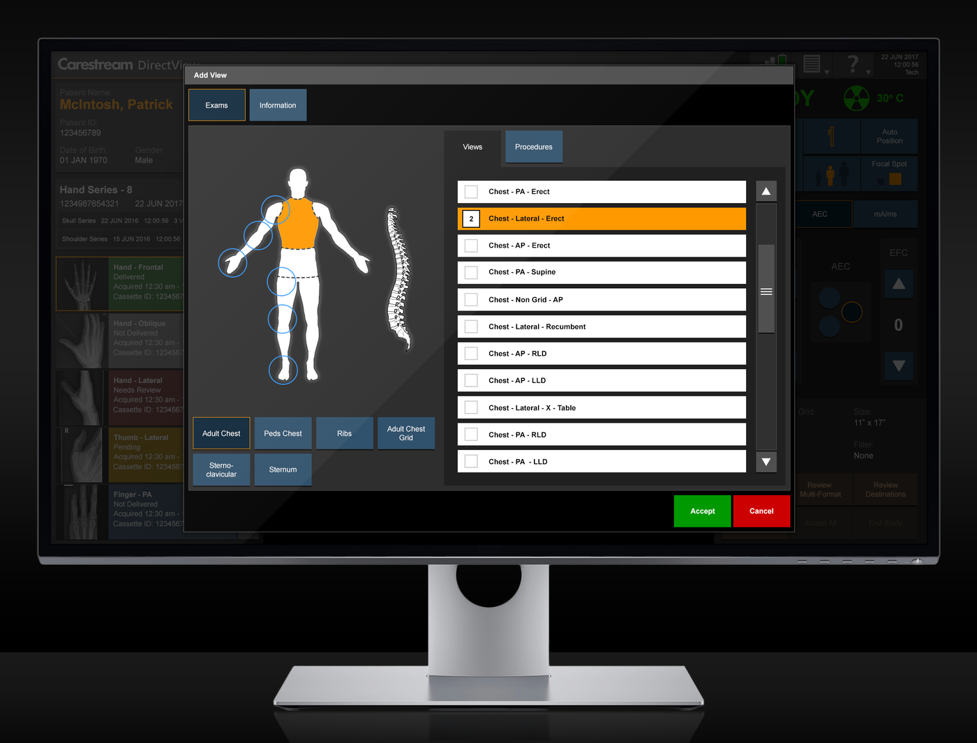 xray cr reader carestream Vita CR - Digital X-Ray | eBay