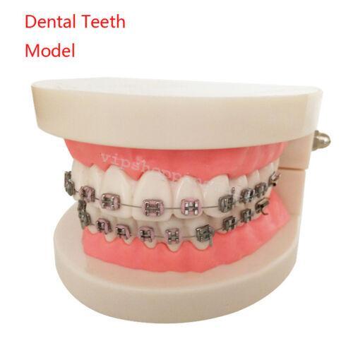 Advanced Dental Teeth Model Set with Brackets and Gum Guide for ...