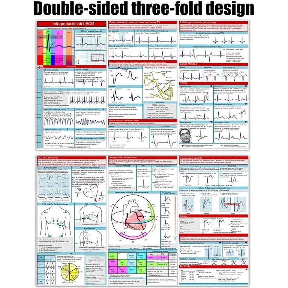 Personalized EKG Pocket Guide DIY EKG Interpretation Book for Nurses ...