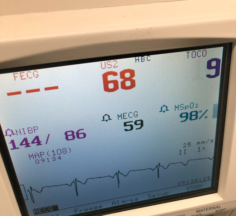 GE Healthcare Corometrics 250cx Series Maternal/Fetal Monitor | eBay