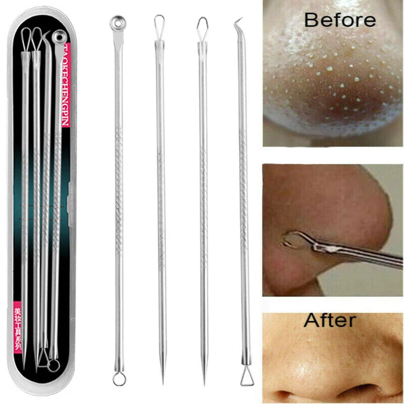 Pimple Extractor