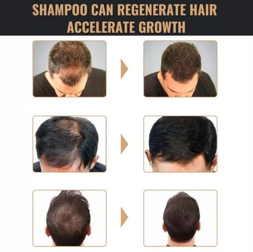 Root Activating Shampoo ,SPARTAN Hair Care Shampoo ,Unisex Hair Shampoo ...