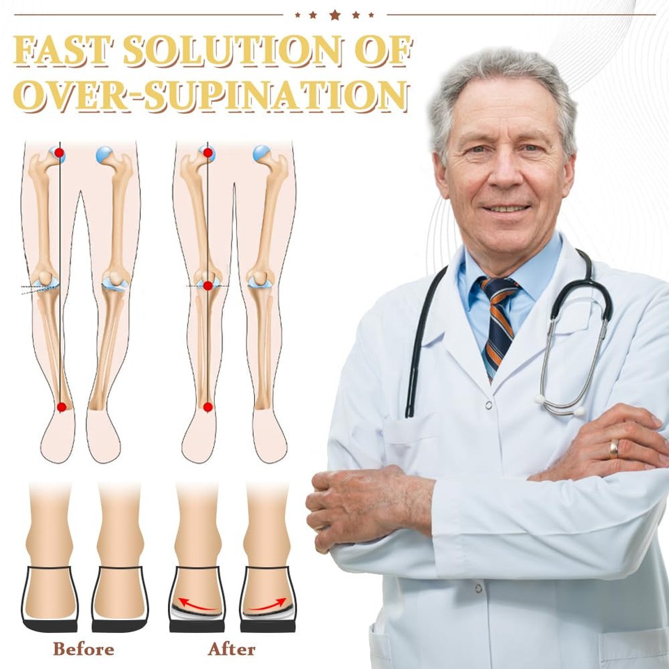 Corrective Insoles for Supination & Over-Pronation, Orthotics Medial ...