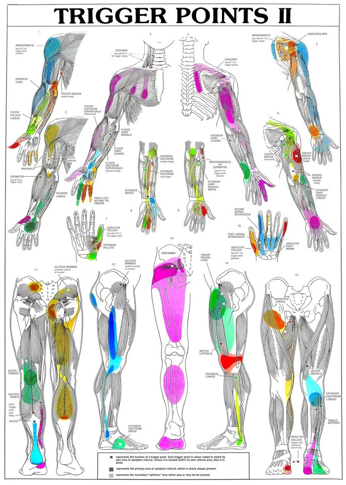 TRIGGER POINTS PART 2 ANATOMICAL DIAGRAM CHART ANATOMY PRINT PREMIUM ...