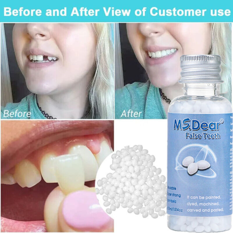 Teeth Repair Temporary Fix Kit Fitting Beads Reusable Fast Moldable ...