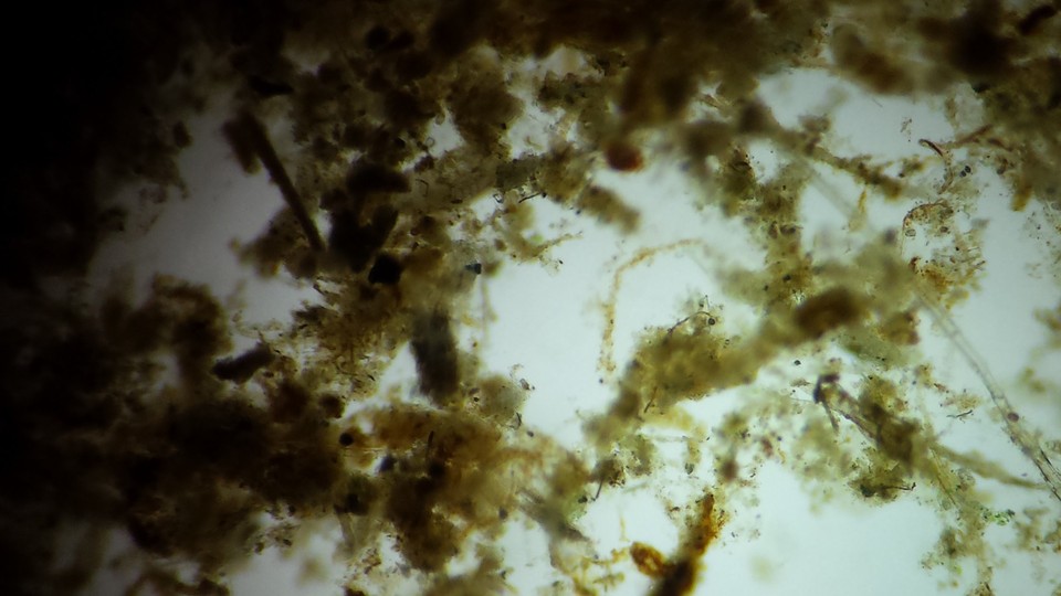 Microscope 32mm Rheinberg Filters Set With Darkfield Lighting ...