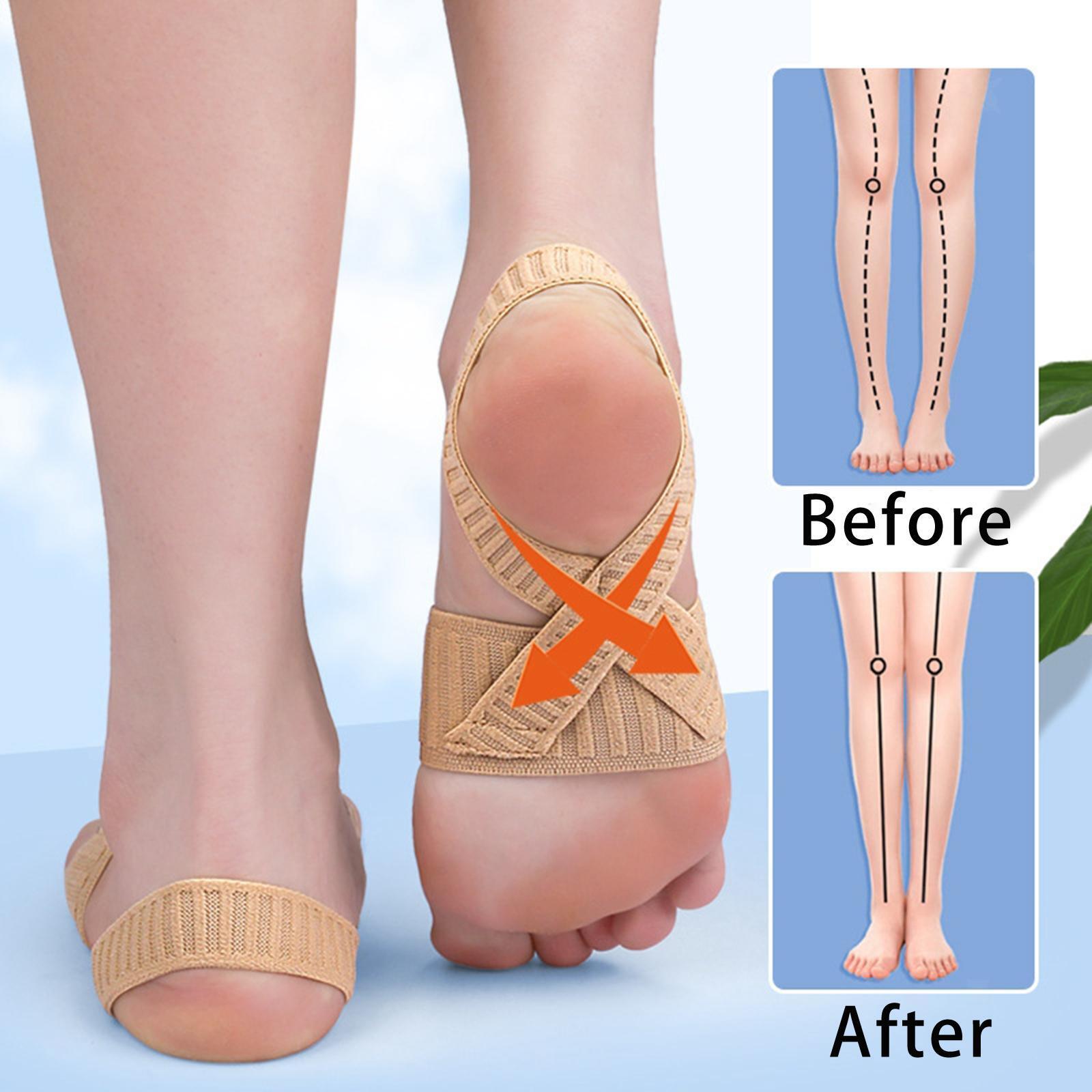 x Brace Breathable Foot Arch Support for Flat Feet Fallen Arches | eBay