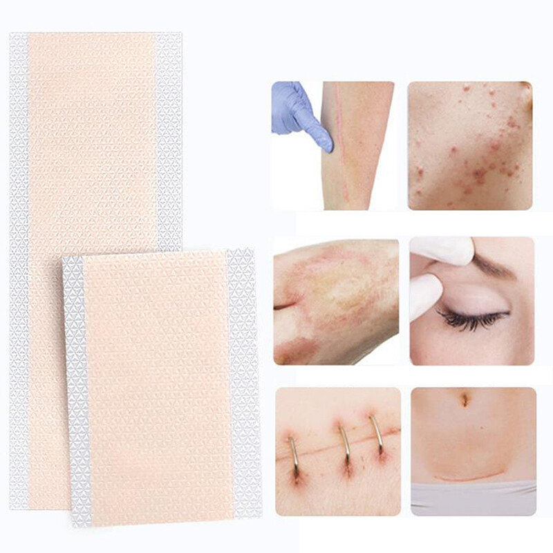 Skin Tattoo Defects Invisible Stickers Birthmark Scars Concealing Tape ...