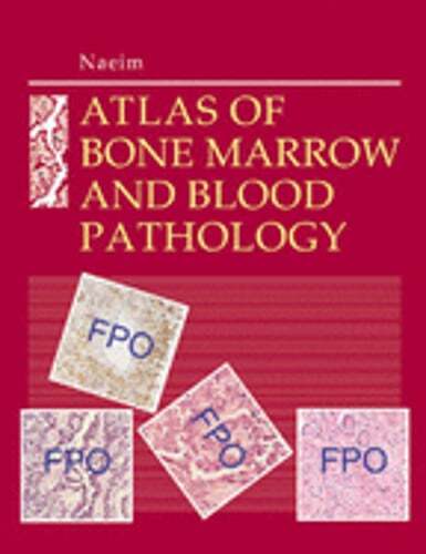 Atlas of Bone Marrow and Blood Pathology: A Volume in the Atlases in ...