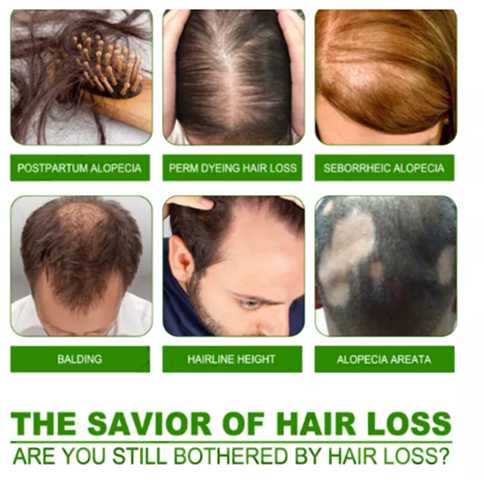 Neo Hair Lotion Hair Root Treatment Original Nutrients Longer Hair ...