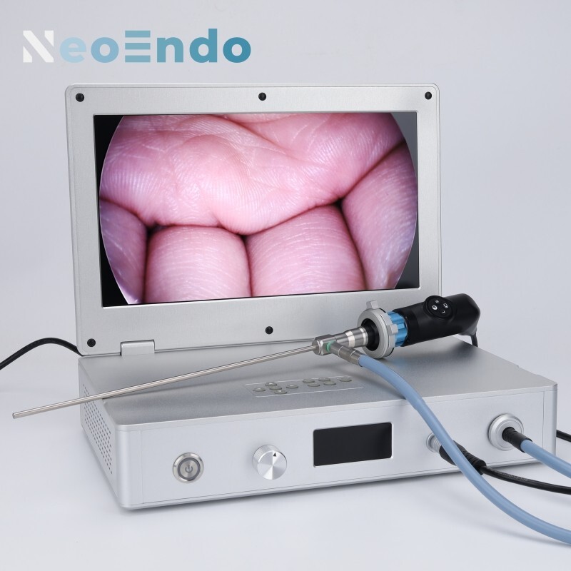HD Portable Medical Endoscope Camera With 15.6 Inch Monitor 80W Light ...