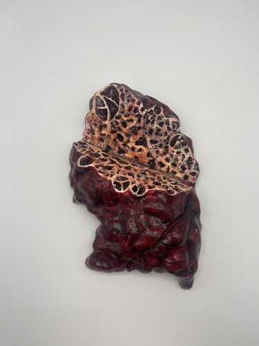 Vintage Lung Emphysema Anatomical Pathology Model Lungs Respiratory | eBay