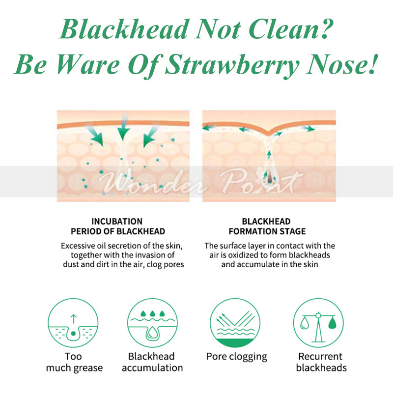 Blackhead Removal Diagram