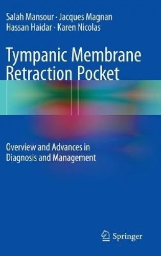 Tympanic Membrane Retraction Pocket: Overview and Advances in Diagnosis ...