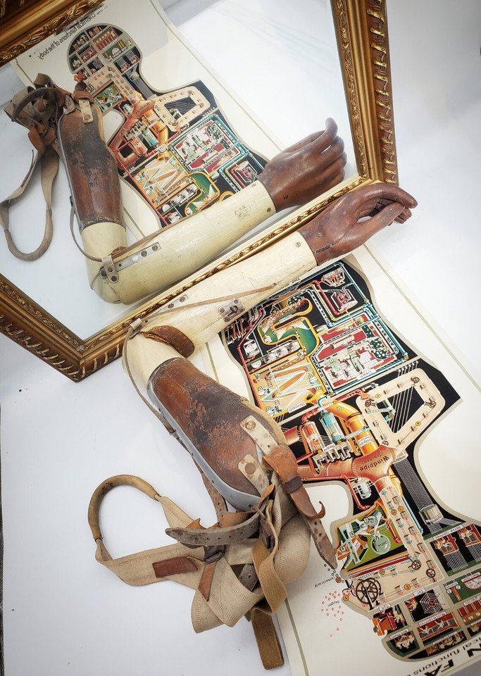 Antique Surgical Medical Leather Wood Prosthetic Arm Hand European ...