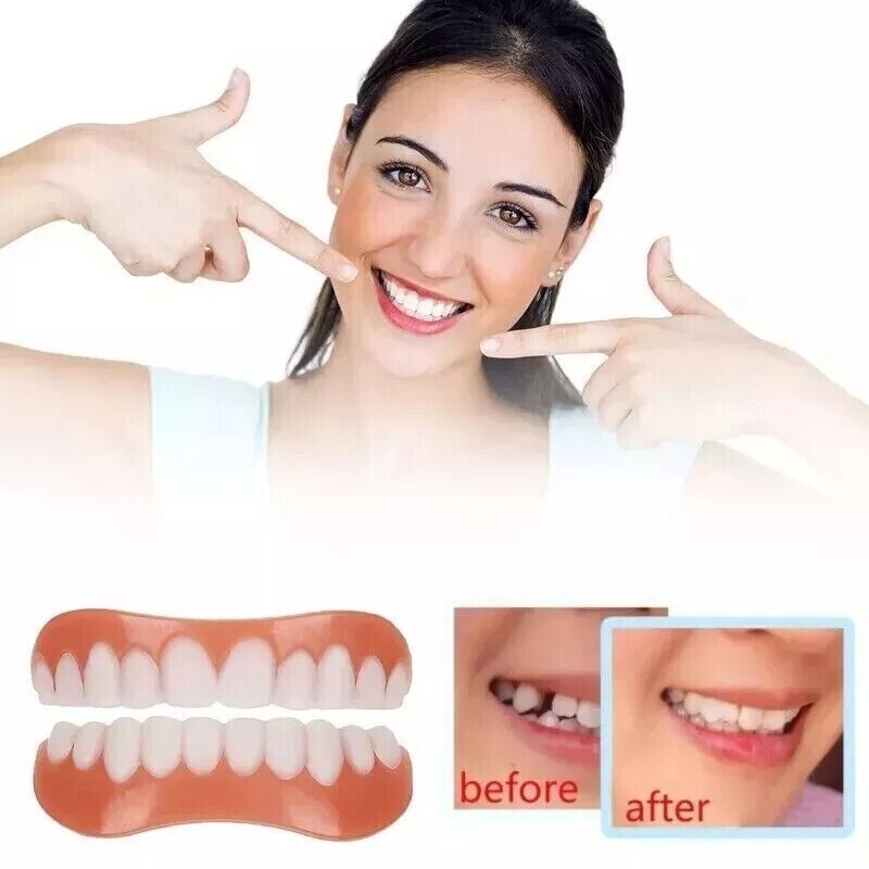 Snap On False Teeth Upper & Lower Dental Veneers Dentures Tooth Cover ...