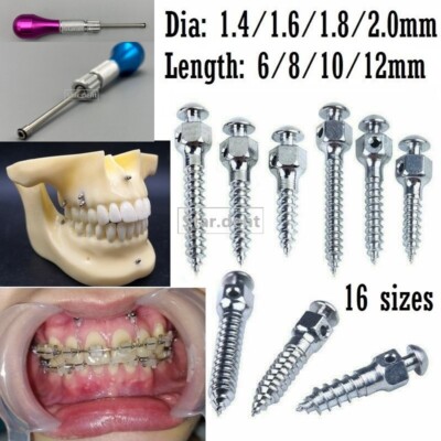 Dental Mini Implant Orthodontic Micro Screws Self Taping Elastics ...