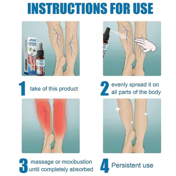 Varicose Vein Spray Herbal Varicose Veins Treatment Spray for Legs ...