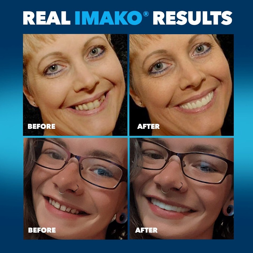 Imako® Premium Cosmetic Teeth 1PK -Small Natural -DIY Smile Makeover ...