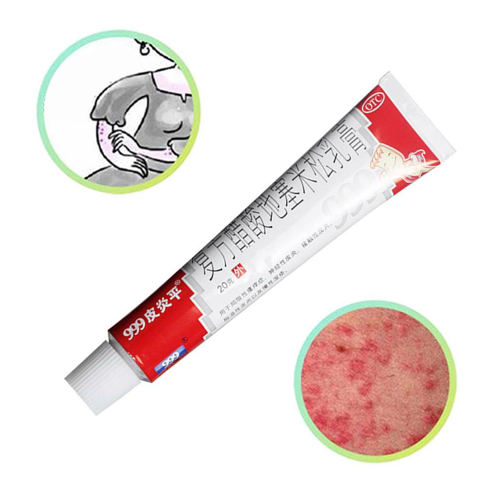 San Francisco Mall 999 Pi Yan Ping Ointment Cream Anti-Inflammatory for ...