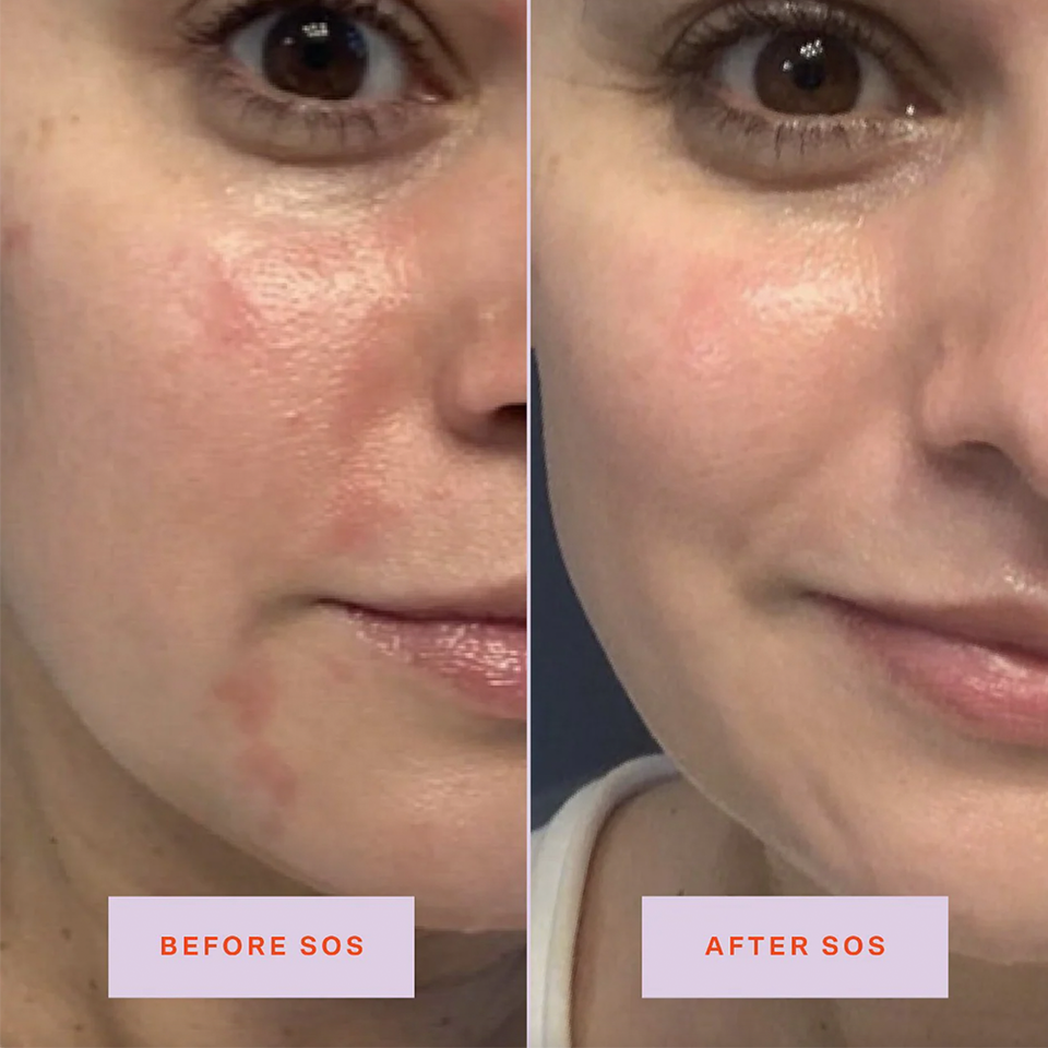 Tower 28 Beauty Mini SOS Daily Rescue Facial Spray, Fragrance Free, New ...