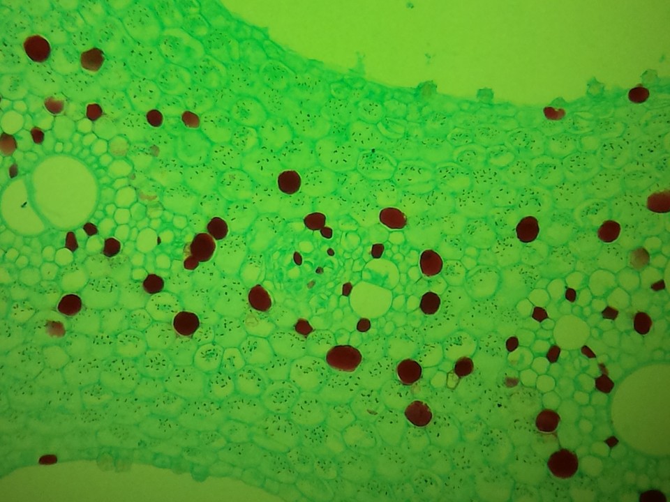 Microscope 32mm Set of Eight Solid Color Filters – Collectors Full ...