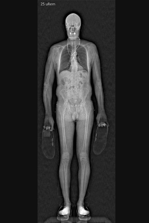 Tek84 Intercept X-ray Body Scanner for Contraband Jail & Prison Use | eBay